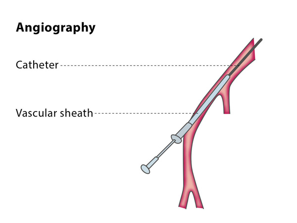 CIRSE - Innovation | Education | Intervention