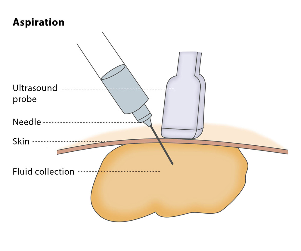 CIRSE - Innovation | Education | Intervention