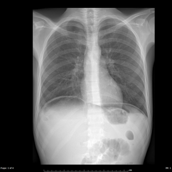 EURORAD - Radiologic Teaching Files