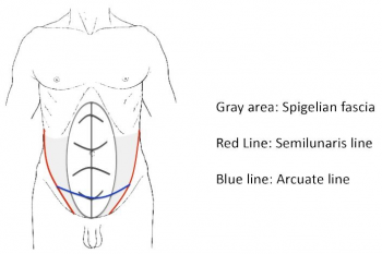Linea Semilunaris Hernia PPT - DISSECTION OF THE ANTERIOR ABDOMINAL ...