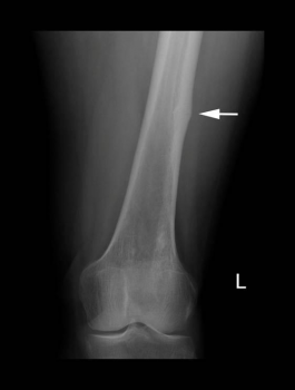 EURORAD - Radiologic Teaching Files
