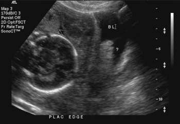EURORAD - Radiologic Teaching Files