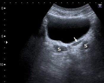 EURORAD - Radiologic Teaching Files