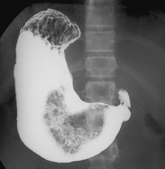 EURORAD - Radiologic Teaching Files