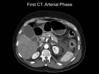 EURORAD - Radiologic Teaching Files